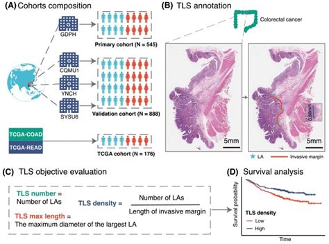 Comparative Analysis Of Tertiary Lymphoid Structures For Predicting Survival Of Colorectal