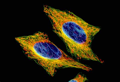 Hela Cancer Cells In Culture Nikon Small World