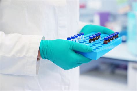 실험실 과학자는 튜브에서 투명 한 액체의 샘플 플라스틱 상자를 보유 하고있다 Stem 주제에 대한 스톡 사진 및 기타 이미지