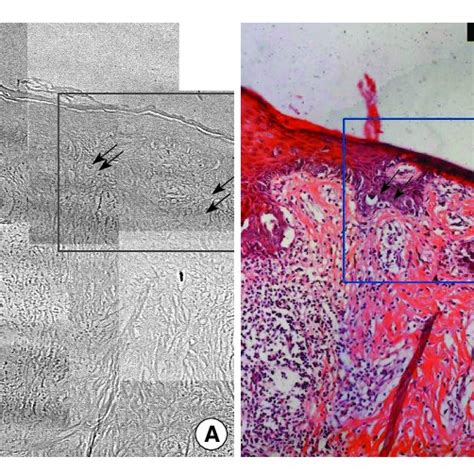 A Phase Contrast Synchrotron Radiation Sr Image And B Optical Download Scientific Diagram