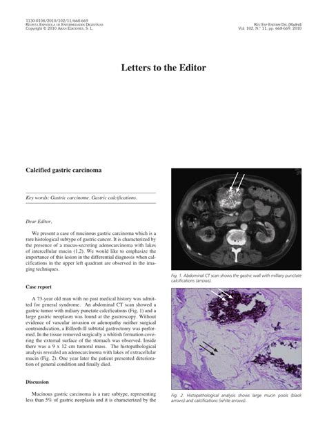 Pdf Calcified Gastric Carcinoma