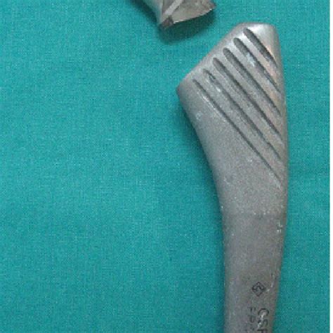 Photograph Of The Retrieved Fully Modular Prosthesis Showing The Download Scientific Diagram