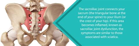What Does Sciatica Feel Like New Jersey Spine And Orthopedic