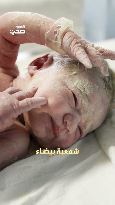 استحمام الرضيع في أول 24 ساعة من ولادته أمر غير صحي Youtube