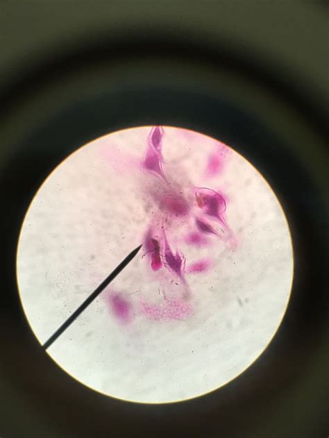 Stentor Ciliates Magnification X Incense Magnification