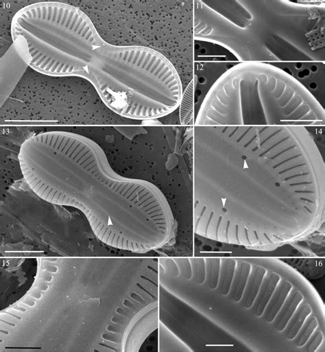 Diploneis Interrupta Sem Fig 10 Internal Valve View Showing