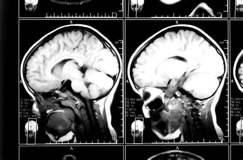 What Happens To Your Brain During Sex Best Health Magazine