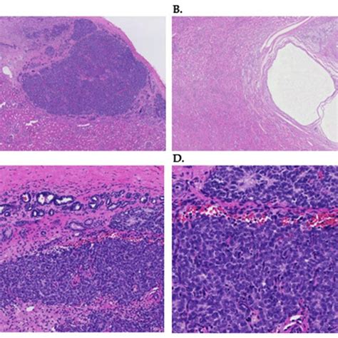A Hematoxylin And Eosin Stained Slide With An Overview Of A