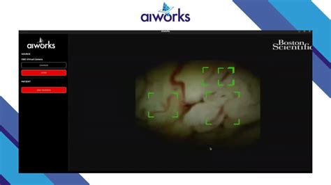 Video Endorx On Linkedin Medicalinnovation Artificialintelligence