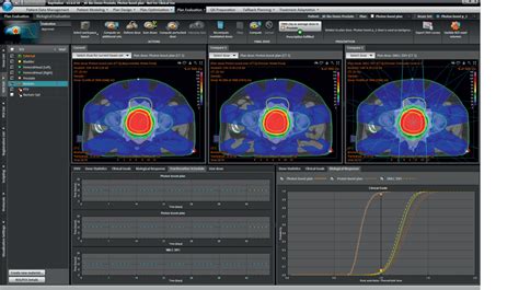 Biological Optimization In Raystation Raysearch Laboratories