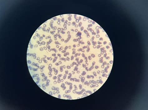 Plasmodium Species Identification Rmicrobiology