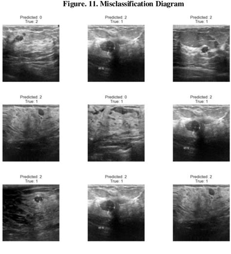 Figure 4 From Enhanced Breast Cancer Tumor Classification Using