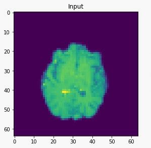 Rendering of T1, T1c, T2, and FLAIR at a resolution of 64 × 64 × 64 ...