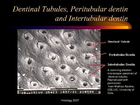 The Histology Of Dentin Pauline Hayes Garrett D