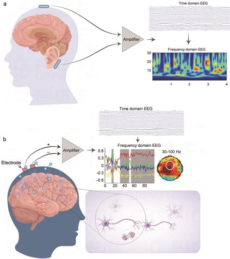 Prevalence Economic Burden And Neurophenotype Of Asthma