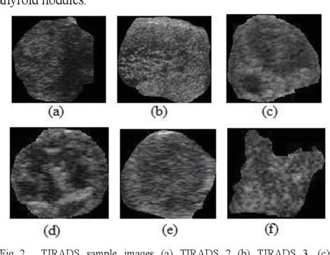 Figure 4 From Classification Of Ultrasound Thyroid Nodule Images Into