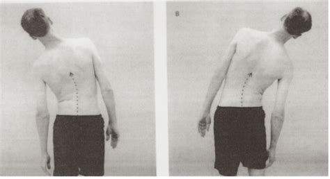 Msk Lumbar Classifications And Interventions Flashcards Quizlet