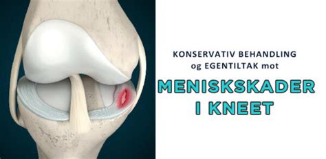 Konservativ Behandling Og Egentiltak Ved Meniskskader I Kneet Din