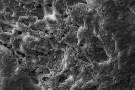 Sem Showinglaser Etched Enamel Surface 1w 2000x Download Scientific Diagram