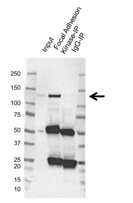 Anti Focal Adhesion Kinase Antibody Clone Oti4a8 Precisionab