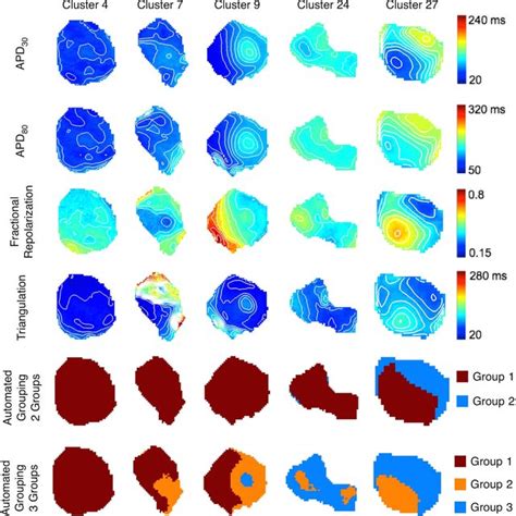 Spatial Maps Of Different AP Parameters Or Groups For Five Different Download Scientific