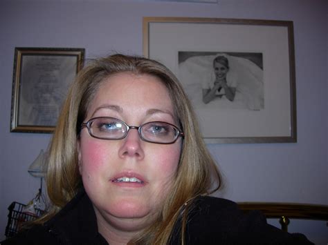 Flop Bott What To Wear On Prednisone Pictures Of Prednisone Belly And