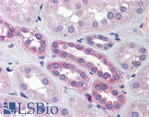 Ihc Plus™ Hif1a Hif1 Alpha Polyclonal Antibody Rabbit Ihcwb Lsbio