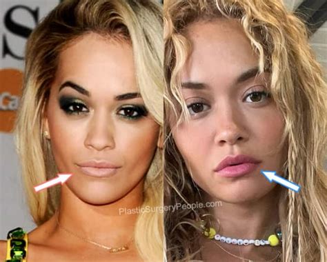 Rita Ora Before And After 2022 Rita Ora Before And After 2022