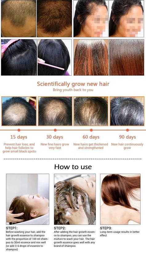 Authentic Andrea Hair Growth Essence Helps Hair Grow Dense Hair Serum