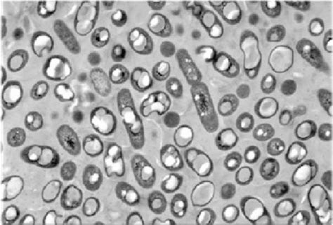Figure 3 From Recent Progress In Microencapsulation Of Active Peptides—wall Material
