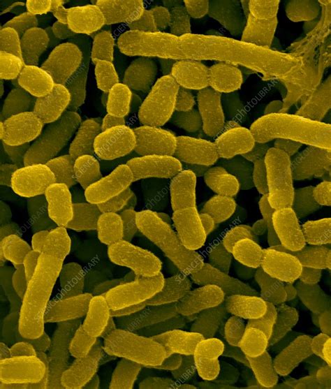 Bovine Rumen Bacterium Sem Stock Image C0322323 Science Photo Library
