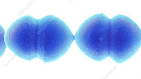 Enterococcus Faecalis Gut Bacteria Sem Stock Video Clip K0113491