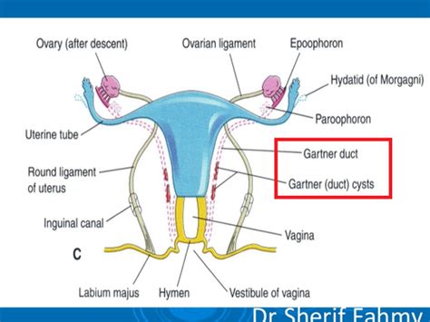 Gartner Duct Cyst What Is It Symptoms And More Osmosis 50 Off