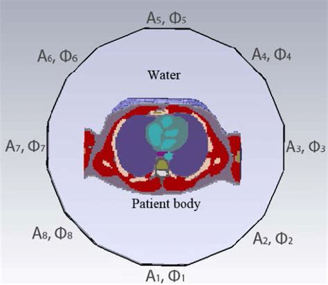Patient Body Surrounded By Phased Dipoles Array Dipole Antennas Have