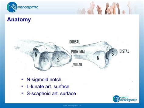 Acute Triangular Fibrocartilage Complex Injuries Treatment