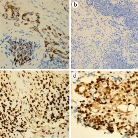 Immunohistochemical Staining A Original Magnification × 400 Panck