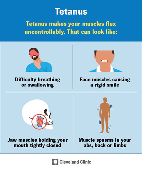Tetanus Symptoms Diagram