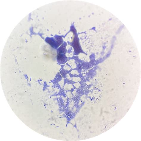 this is a gram stain of b subtilis you can see those rod shape cells