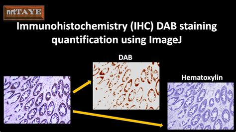 Immunohistochemistry IHC DAB Staining Quantification Using ImageJ