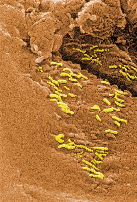 Colour Electron Micrograph Of Martian Microfossils Photograph By Nasa
