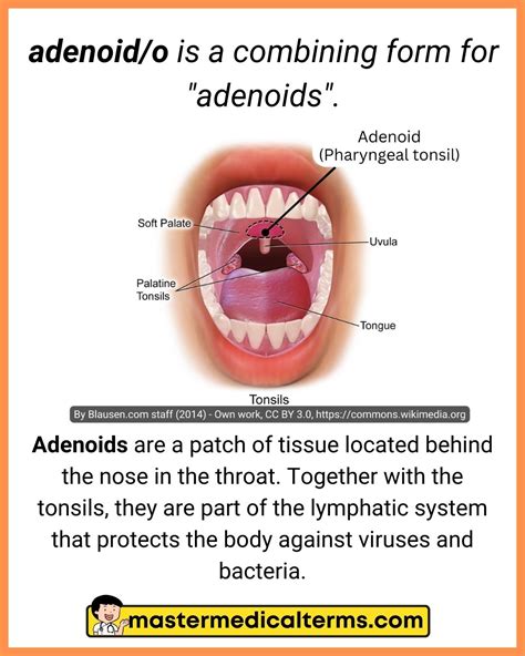 Adenoid