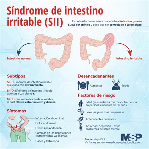 Síndrome de Intestino Irritable Infografía