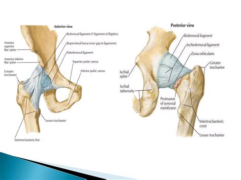 Proximal Femur Fractures With Nof And It Pptx