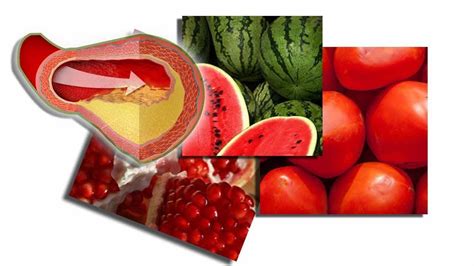 Gk υψηλη πιεση υπερταση και διατροφη τροφεσ για υπερταση Youtube