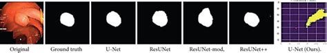 Qualitative Results Comparison On The Kvasir Seg Dataset From The