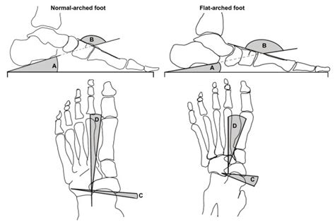 Radiographic Measurements Traces From Two Representative Participants