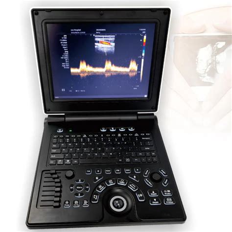 Notebook Color Doppler E20