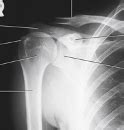 Imaging Exam Shoulder Elbow Wrist Hand Flashcards Quizlet