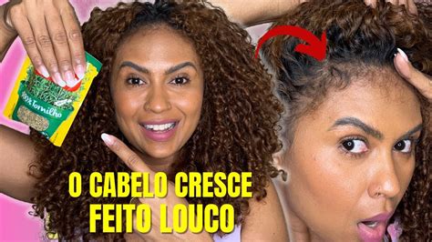 Nasce Cabelo AtÉ Na Testa A Receita Caseira Mais Potente Para Crescer