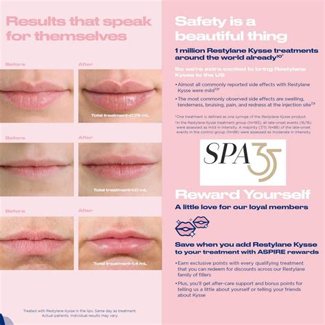 Before And After Photos Juvederm In Lips Cost